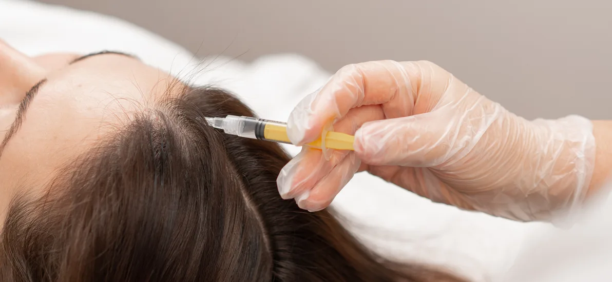 Unlock the Full Potential of Your PRP Hair Restoration